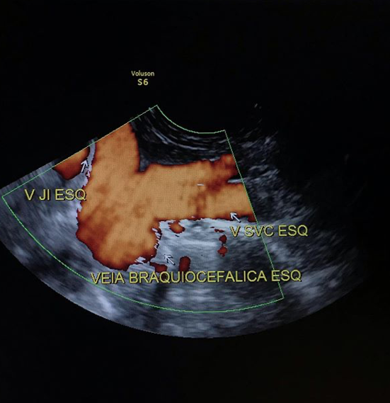 Ultrassom Doppler - Cirurgia Vascular